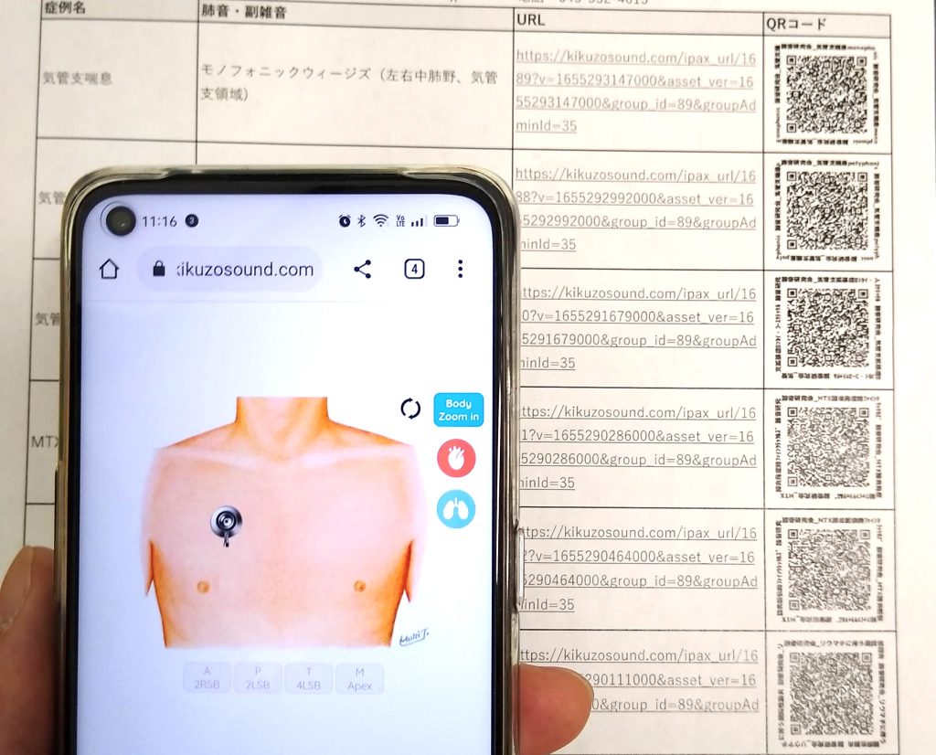QRコードでiPaxを配布する | テレメディカのブログテレメディカのブログ